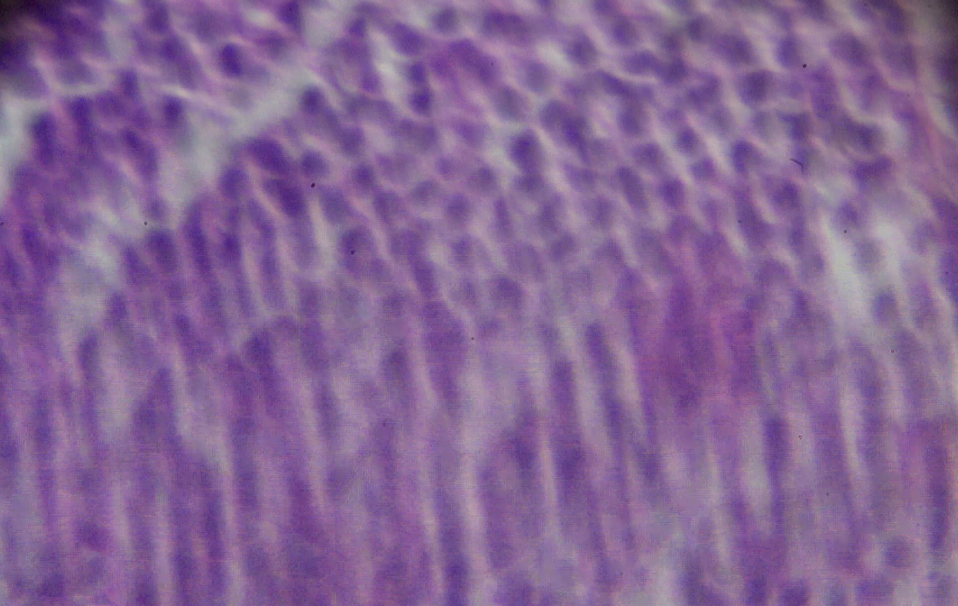 St.Gallen International Breast Cancer Conference / St.Gallen Oncology ...